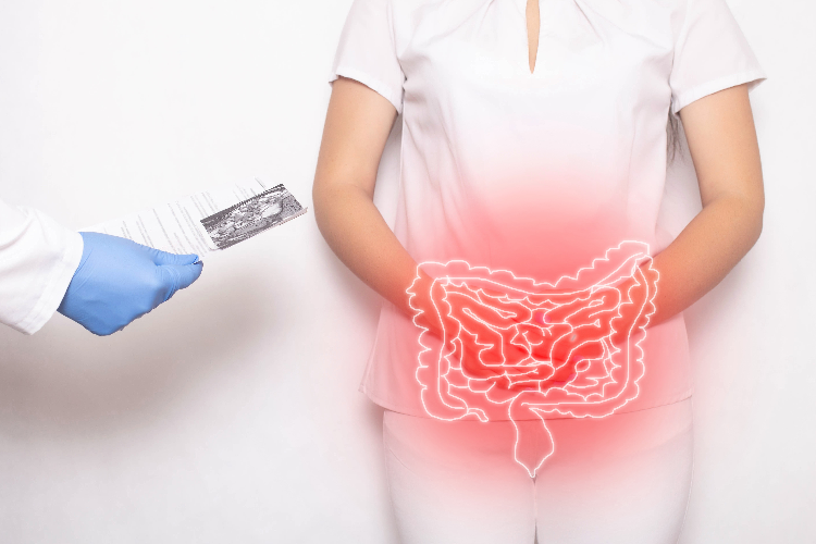5 síntomas del colon irritable que debes conocer | esVivir