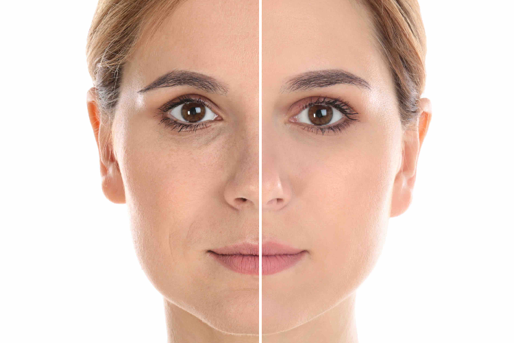 Full Face, el nuevo protocolo para redibujar el rostro | esVivir